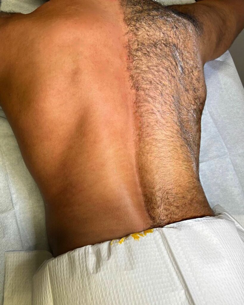 Back Waxing Services - Full & Half Back | Waxing the City